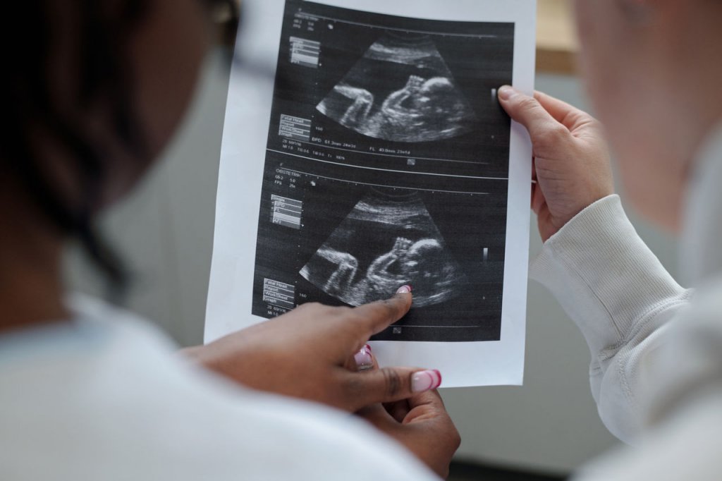 Advanced Delivery Program