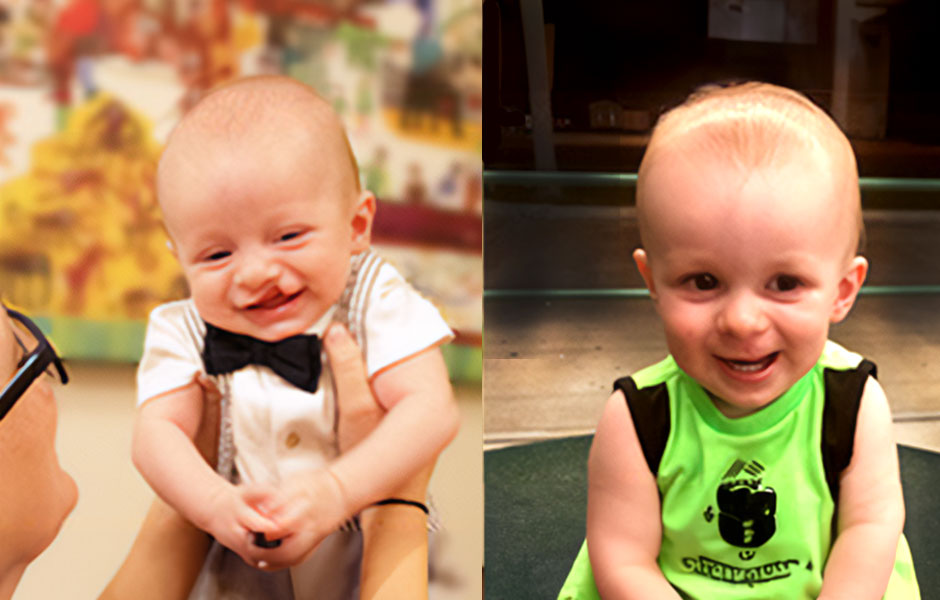 Center for Cleft & Craniofacial Differences, Central Florida